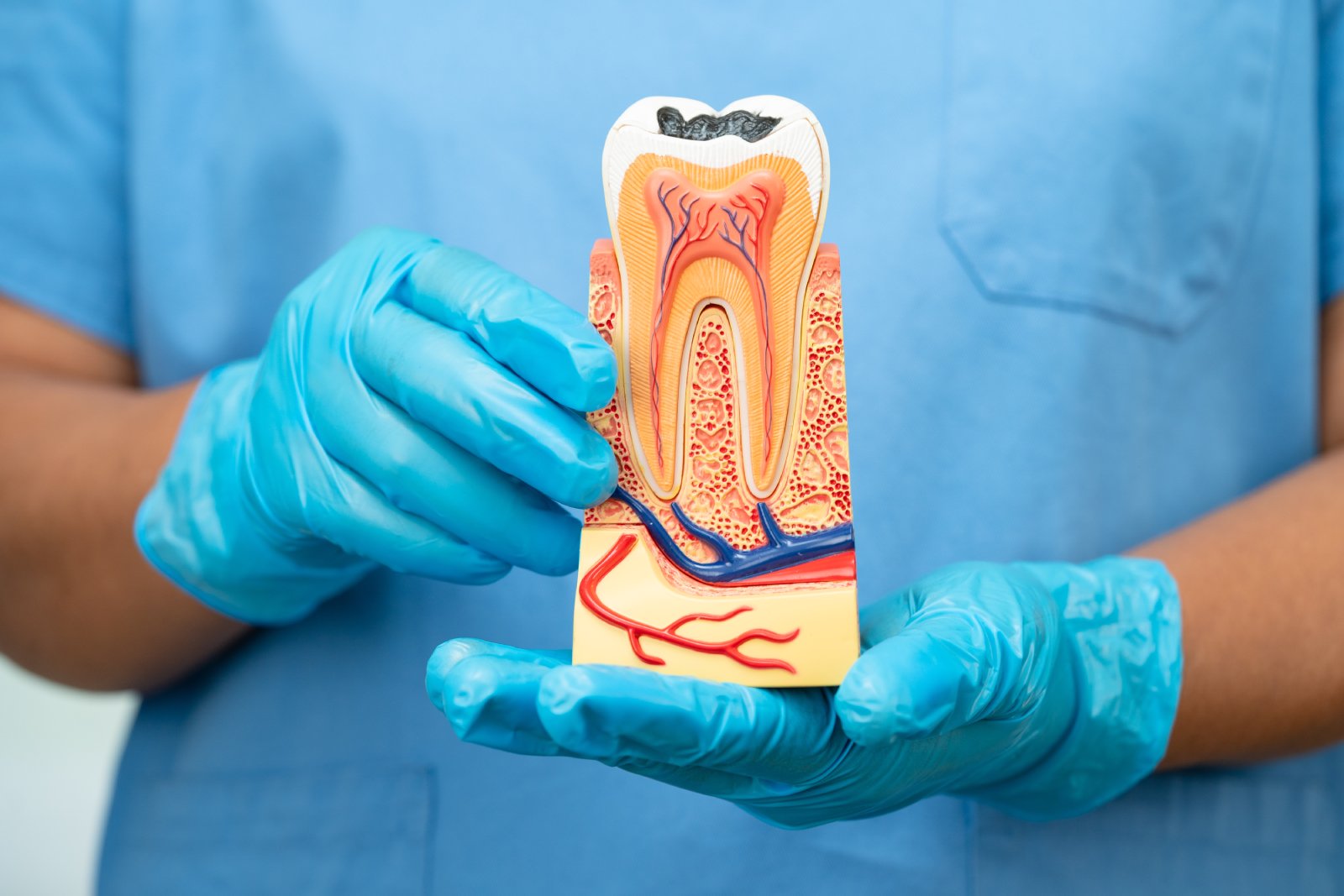 Truth About Root Canals: Do I Need a Root Canal?